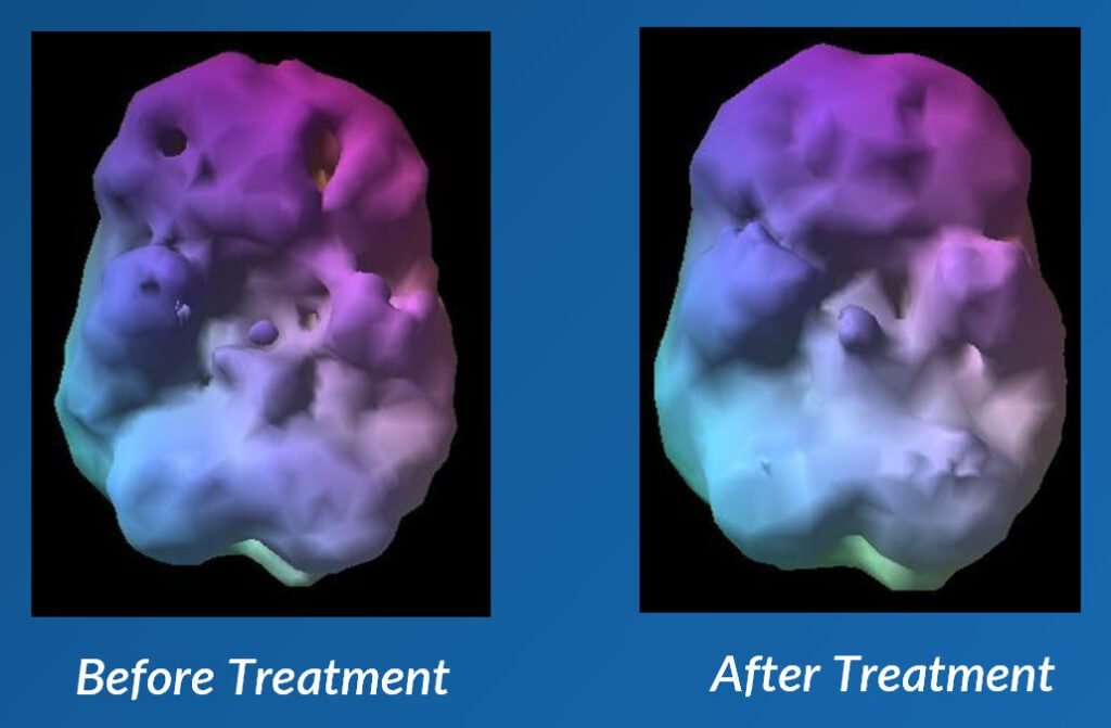 Who is Dr Daniel G Amen: His Work and FAQ’s